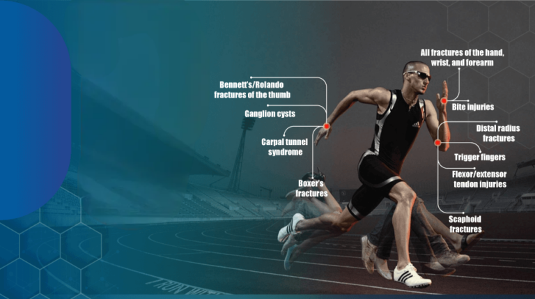 Hand and Wrist Injuries - Orthopaedic Associates of Southern California